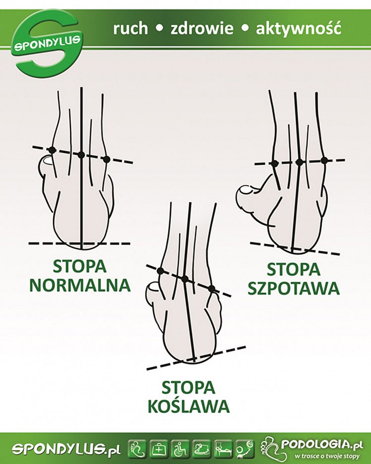 Jak zadbać o zdrowie stóp (i nie tylko) dziecka? Specjalista odpowiada ...